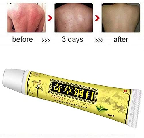 2Pcs Face Cream, Body Cream, Anti-Itch Cream External Use Only ...